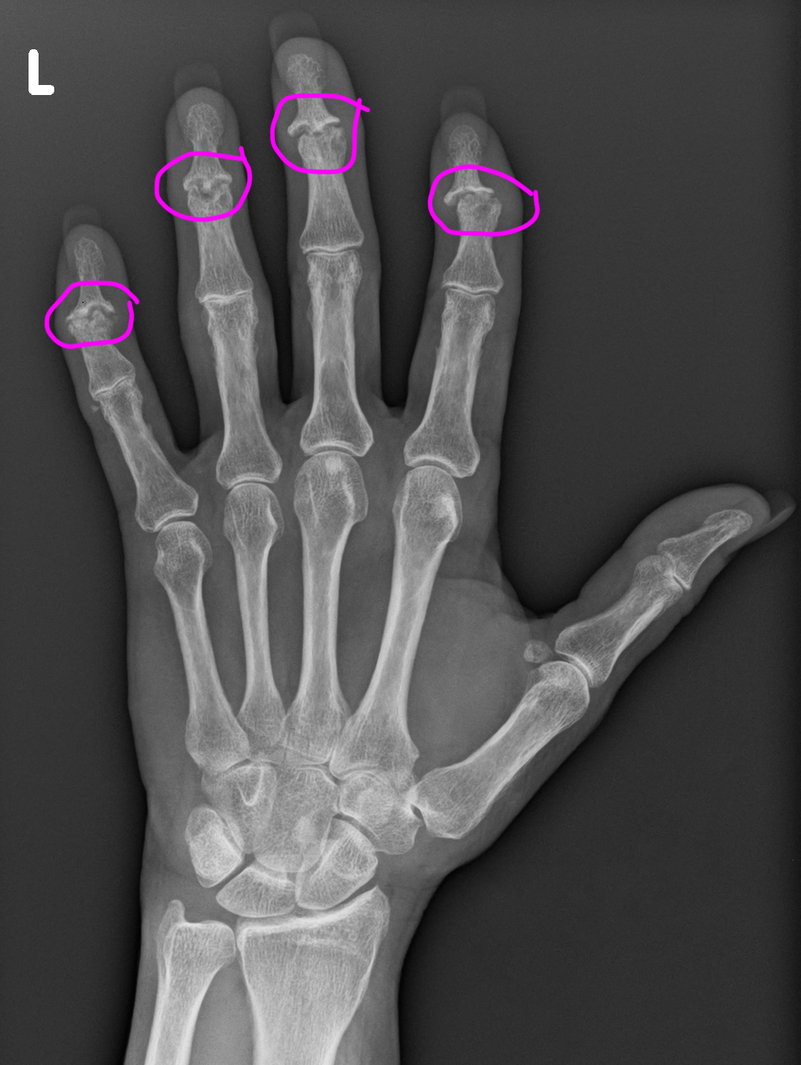 Interactive Case Explorer